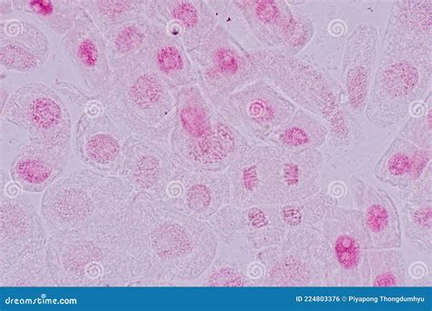 Metaphase Microscope