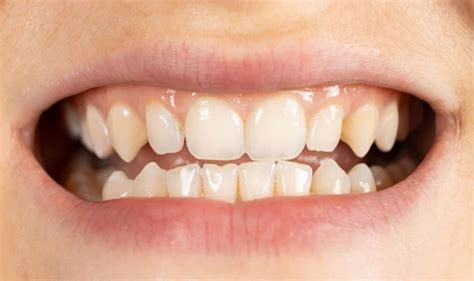 Dental Physiognomy Predicting Personality And Destiny