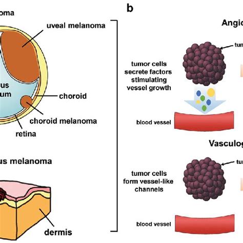 A Graphical Representation Of Different Melanoma Types B Different Download Scientific Diagram