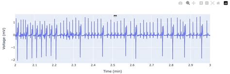 Building A Dashboard In Plotly Dash Towards Data Science