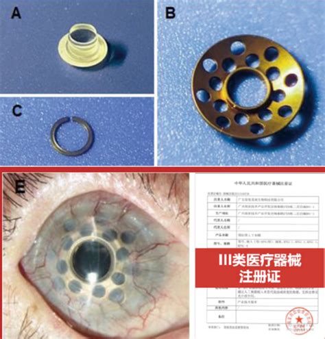 国内首创！用动物眼角膜，弥补供体短缺，助力复明！ 博普智库