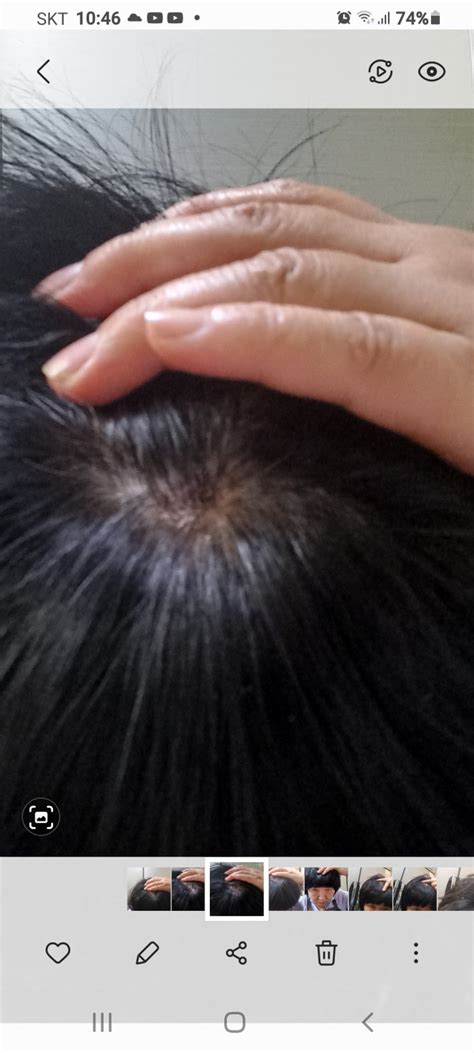 머리속 점 얼마전에 우연히머리를 만져 지식in