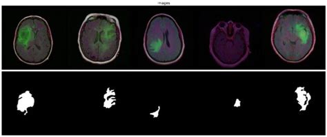 Mri Images And Their Corresponding Tumor Masks In The Dataset