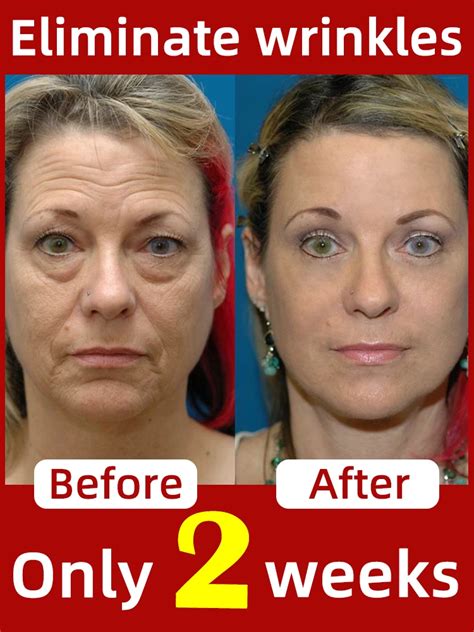 S1407e66501394ff394145192035996bfG