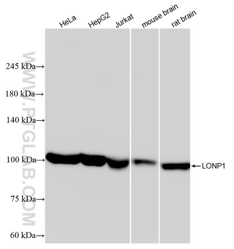 Lonp1 Antibody 83552 2 Rr Proteintech