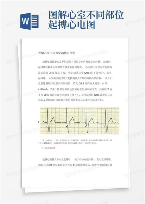 图解心室不同部位起搏心电图word模板下载编号qrzdbzme熊猫办公