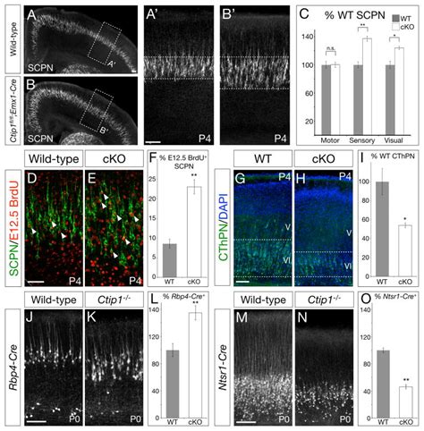 Ctip1 Regulates The Balance Between Specification Of Distinct
