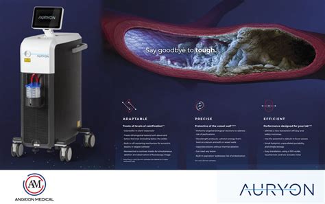Peripheral Atherectomy Lasersystem Isr Peripheralarterydisease Angeion Medical