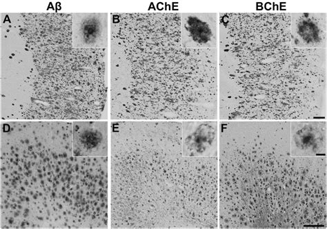 Representative Photomicrographs Showing Staining Of Plaque Pathology Download Scientific