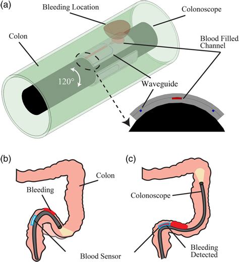 Internal Bleeding Diagram