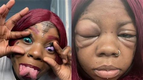 Lady Goes Blind After Tattooing Her Eyeballs Blue And Purple Photos