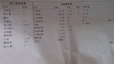 尿路感染尿颜色女性尿路感染症状 伤感说说吧