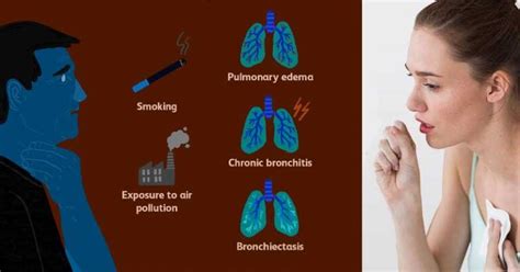 Най добрия глюкомер Мнения Топ 10 апарати Лечител Net
