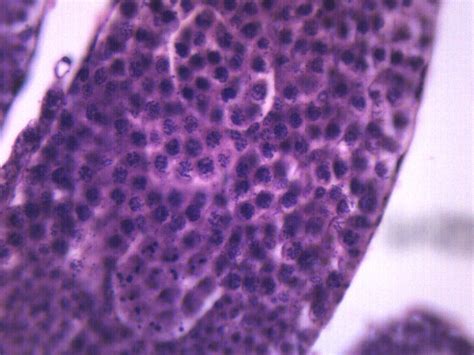 Testes Slide