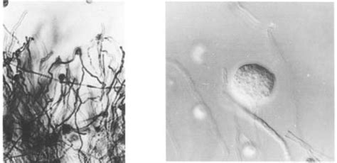 Pythium Insidiosum From A Slide Culture Of Cornmeal Figure 4 Pythium