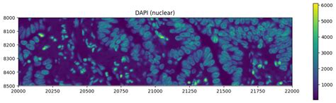 Technology Focus Xenium — Spatialdata