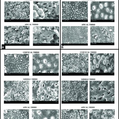 Comparison Of Smear Layer Removal Between Different Groups Download