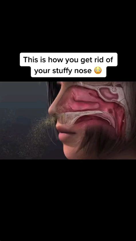 Useful Method To Get Rid Of Your Stuffy Nose Try It Stuffy Nose