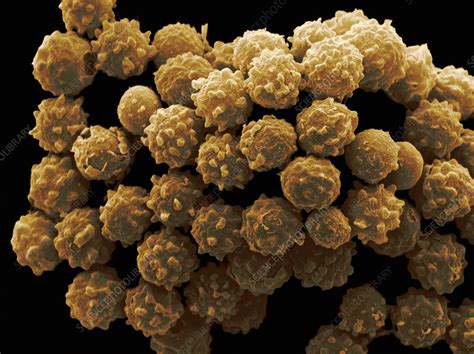Aspergillus Niger Spores Stock Image C0015283 Science Photo Library