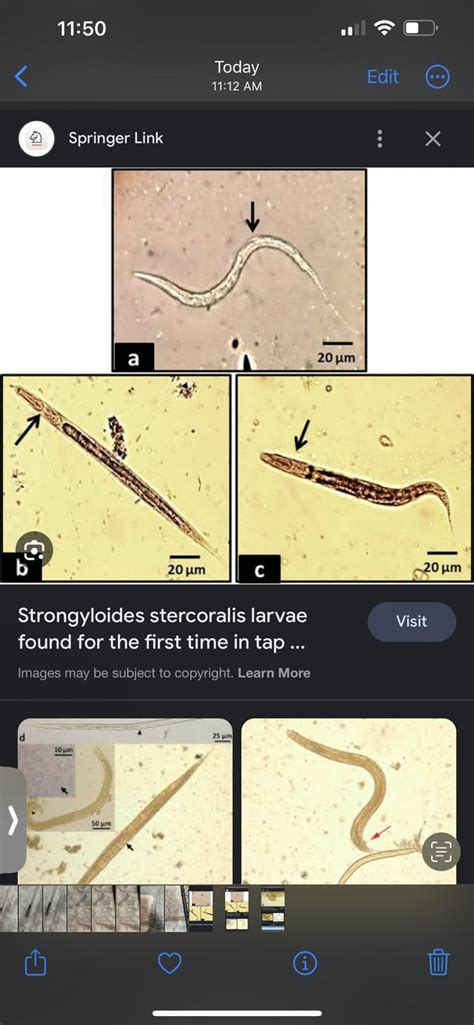 Found This On Rmicroscopy Horrifying This Is How I Removed A Scabie