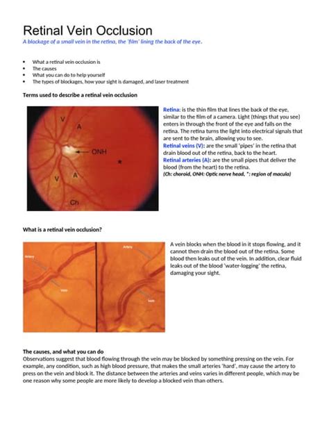 Retinal Vein Occlusion Patient Education Docx