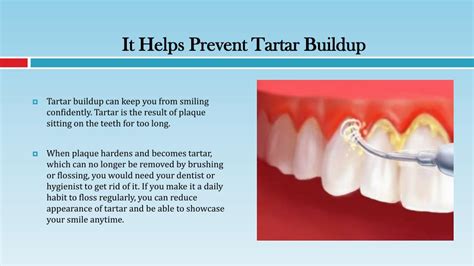 Ppt Why Flossing Is Essential For Your Dental Health Powerpoint