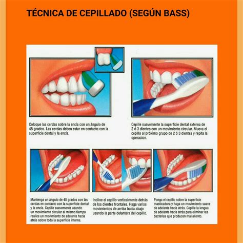 La Tecnica De Cepillado Dental Es Muy Importante M S Importante Que El
