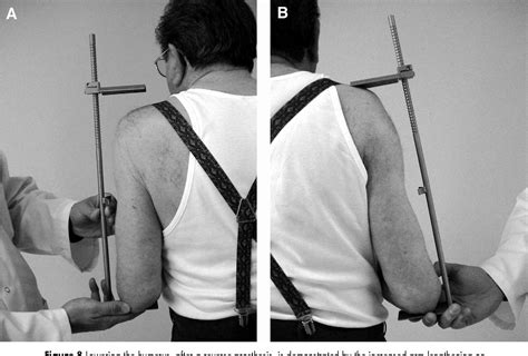 Structure Of Deltoid Muscle Semantic Scholar