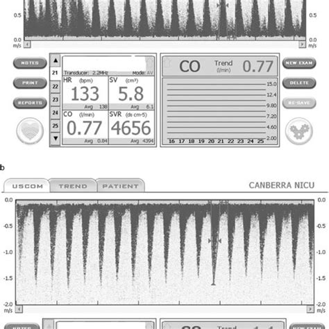 Pdf Non Invasive Assessment Of Cardiac Output With Portable
