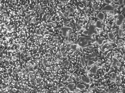 Hek293 Cell Line A Cornerstone In Modern Cellular Research And
