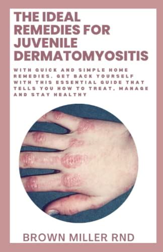 The Ideal Remedies For Juvenile Dermatomyositis With Quick And Simple