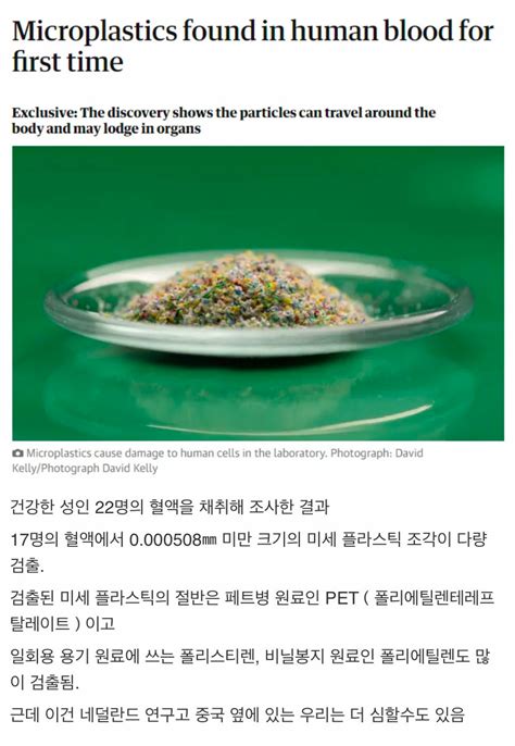 혈관에 미세플라스틱이 흐른다고요 포텐 터짐 최신순 에펨코리아