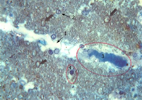 Microstructure Of Fascicular Portions Of The Corpus Callosum Of Adult Download Scientific