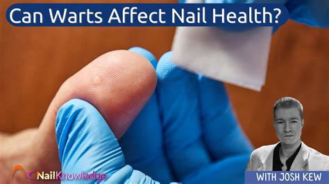 Brittle Nails Causes Prevention And Treatment Nailknowledge