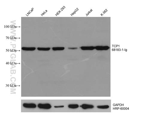 tcp1 antibody 68183 1 ig proteintech