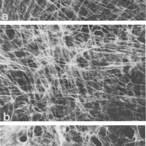 Fitc Gelatin Stainable Extracellular Matrices Unfixed Cef Cells Were