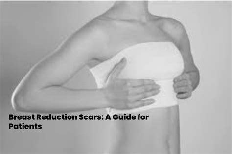 Breast Reduction Scars A Guide For Patients