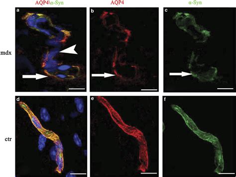 Confocal Dual Immunofluorescence Reaction Of Aqp4 Red And
