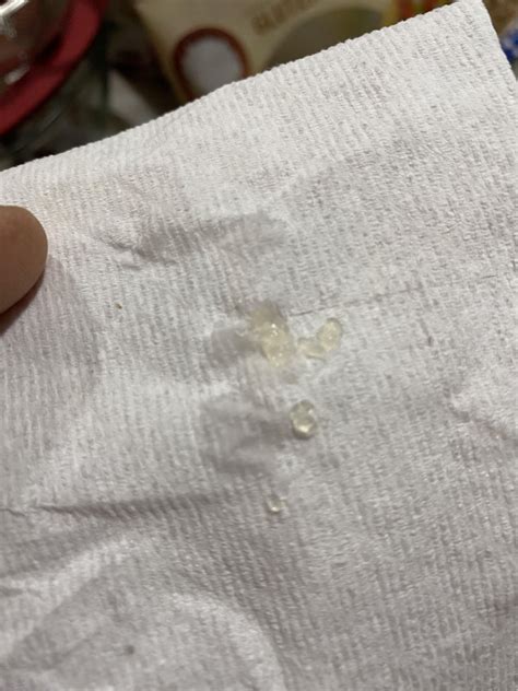 Are Chunks Like This Normal For Semen Rsexquestions
