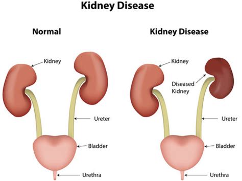 "Urinary System" Bilder – Durchsuchen 8,778 Archivfotos, Vektorgrafiken ...