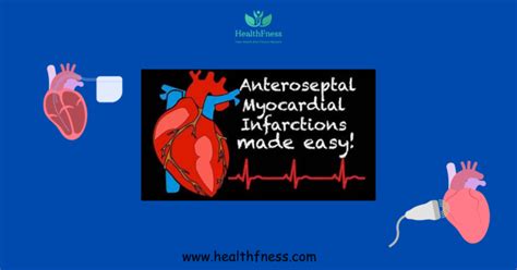 Anteroseptal Myocardial Infarction Causes Symptoms And Treatment 2024