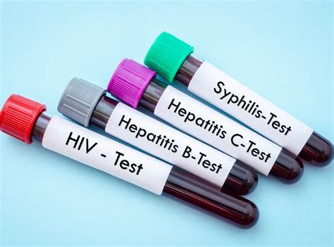 Hiv Hepatitis Project Aims To Reduce Health Inequities Healthtimes