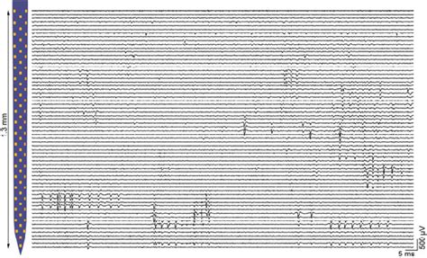 5 Parallel Recording Capabilities Of The Multiplexed Neurophysiological