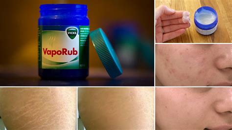 8 Surprising Uses Of Vicks Vaporub