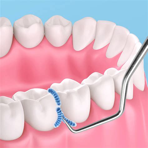 Dental Tools Set Sobarponno