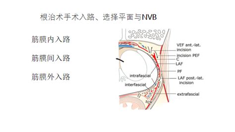保留性神经前列腺癌根治术（技巧与创新） 张保