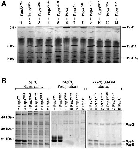 A Silver Stained Isoelectric Focusing Gel Electrophoresis