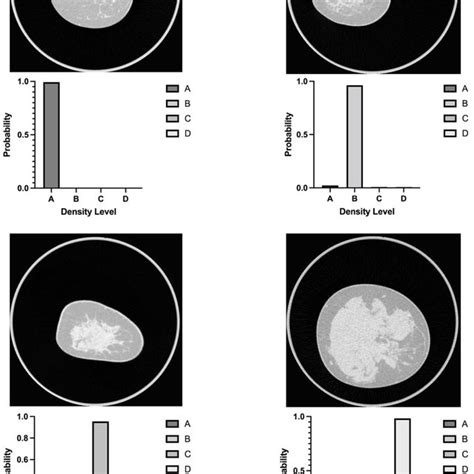 Example Dcnn Evaluations For Breast Ct Images Showing Different Density