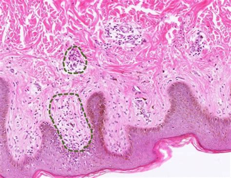 Diffuse Immune Tissue Flashcards Quizlet