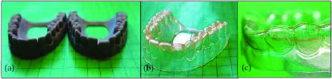 Digitally Modeled And 3D Printed Denture Without Malocclusion A Left